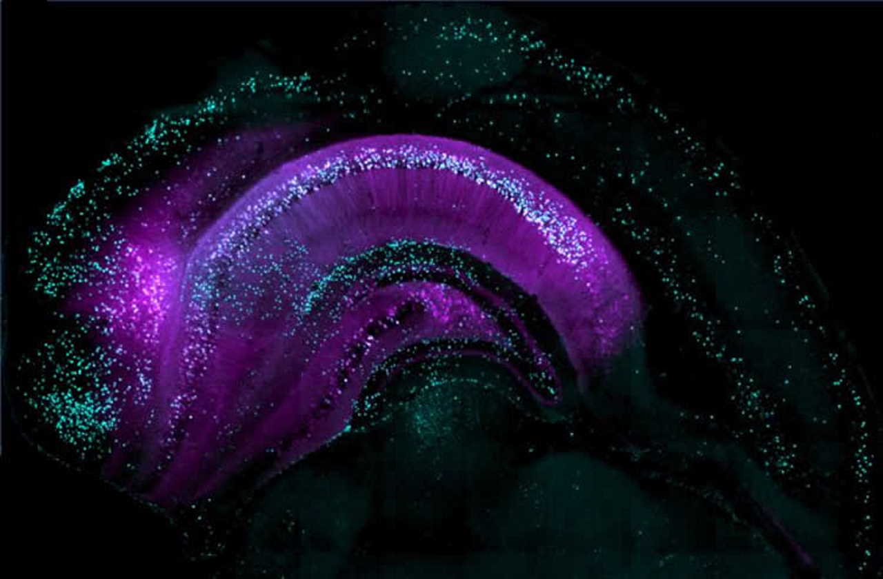 Вчені простежили за активністю мозку при помилкових пригадуваннях ...